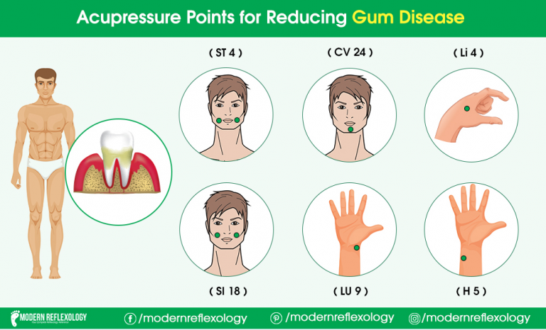 Acupressure Points For Reducing Gum Disease Modern Reflexology